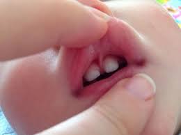 Gap in newborn gums store